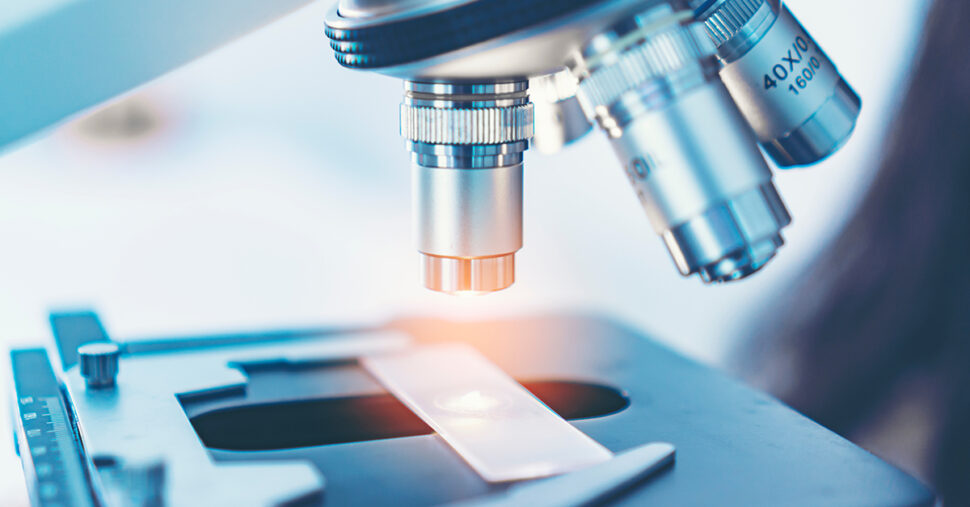 Polylysine From Microscope Slides - TechNotes – Critical Cleaning ...